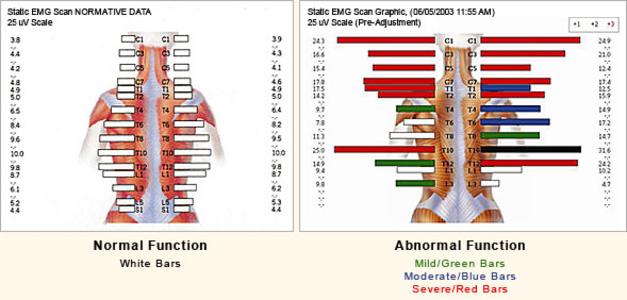 Spinal and Postural Screenings | Southington, CT Chiropractor | Raya Clinic